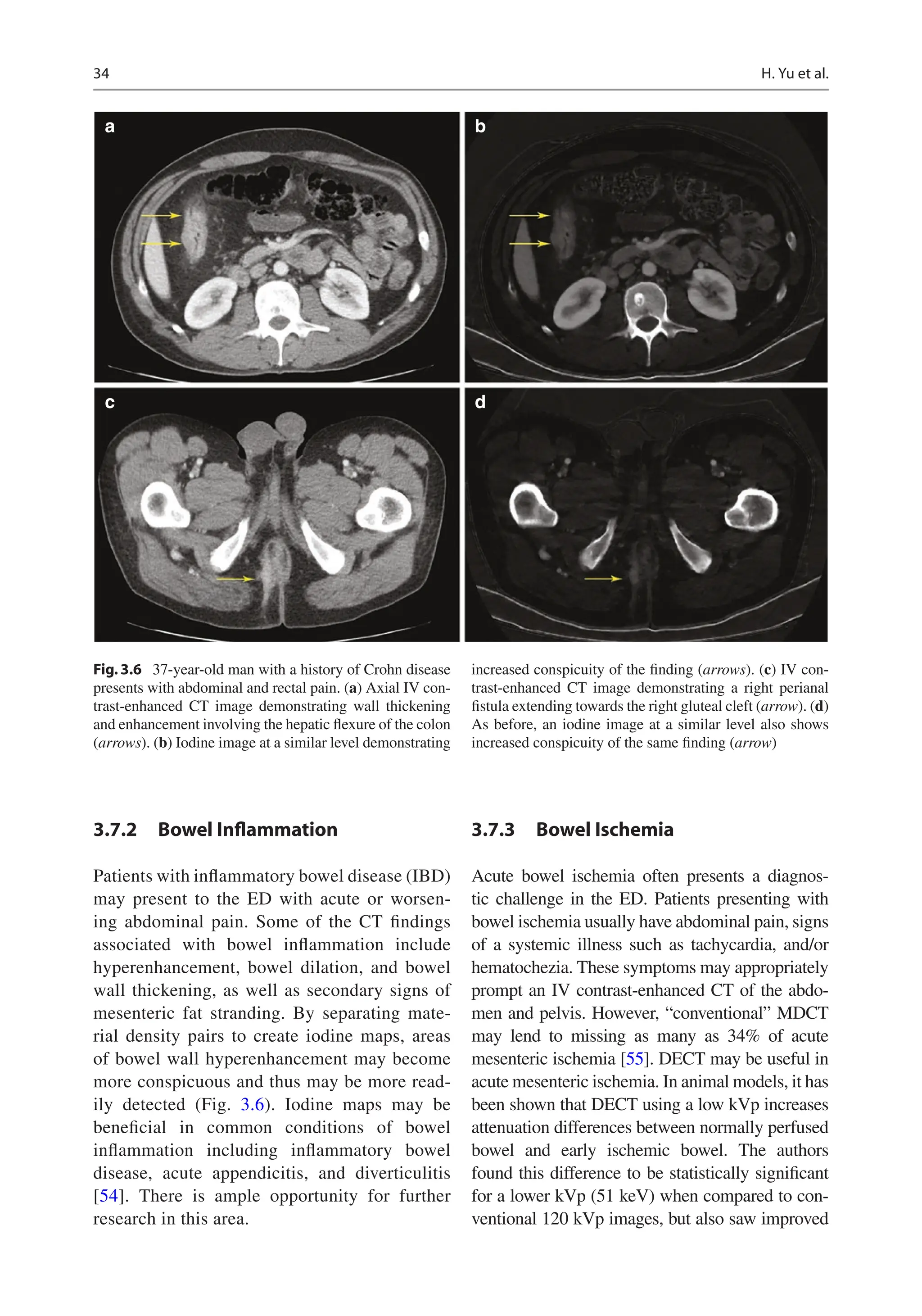 mdct-and-mr-imaging-of-acute-abdomen_compress.pdf