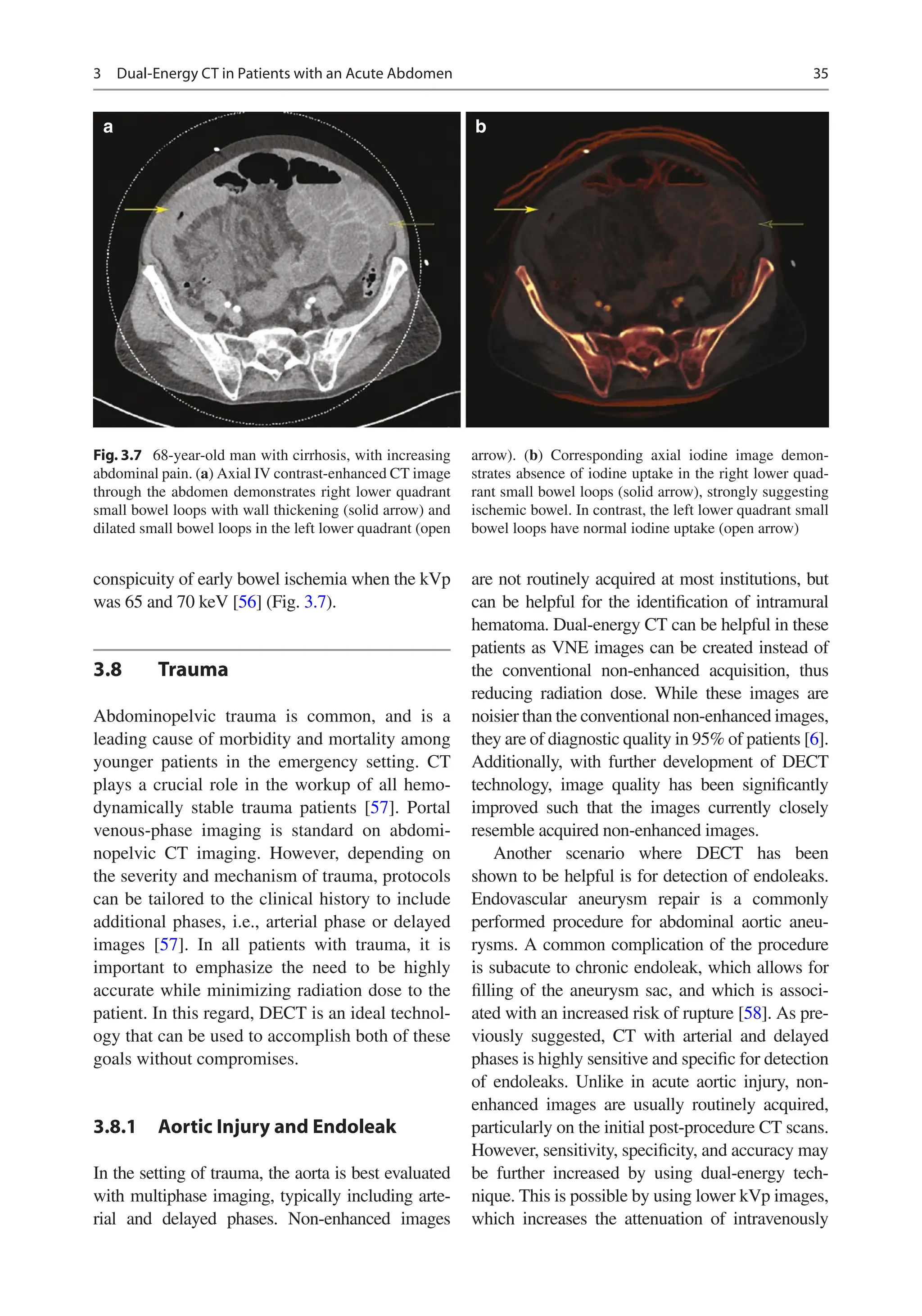 mdct-and-mr-imaging-of-acute-abdomen_compress.pdf