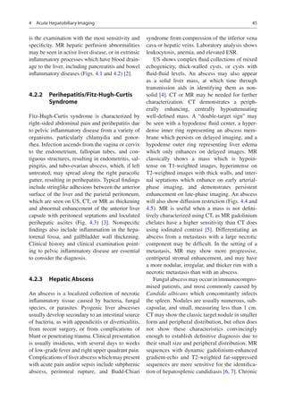 mdct-and-mr-imaging-of-acute-abdomen_compress.pdf