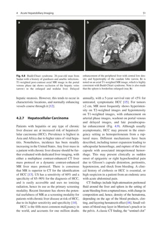mdct-and-mr-imaging-of-acute-abdomen_compress.pdf