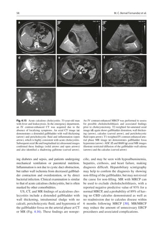 mdct-and-mr-imaging-of-acute-abdomen_compress.pdf