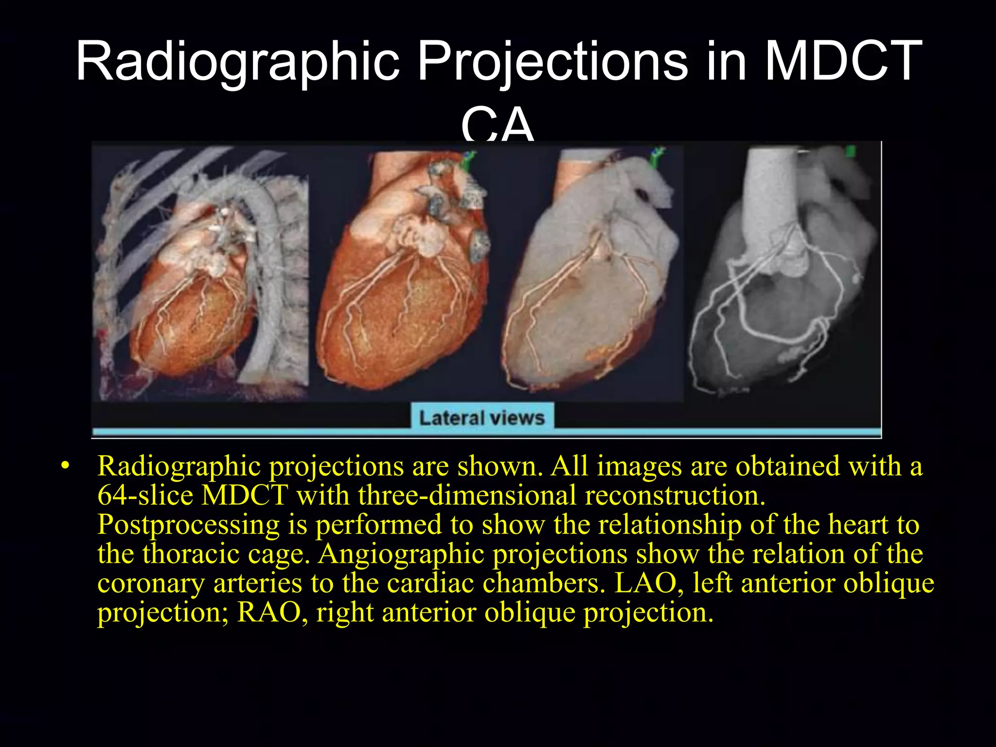 MDCT Anatomy of Heart Dr. Muhammad Bin Zulfiqar | PPTX