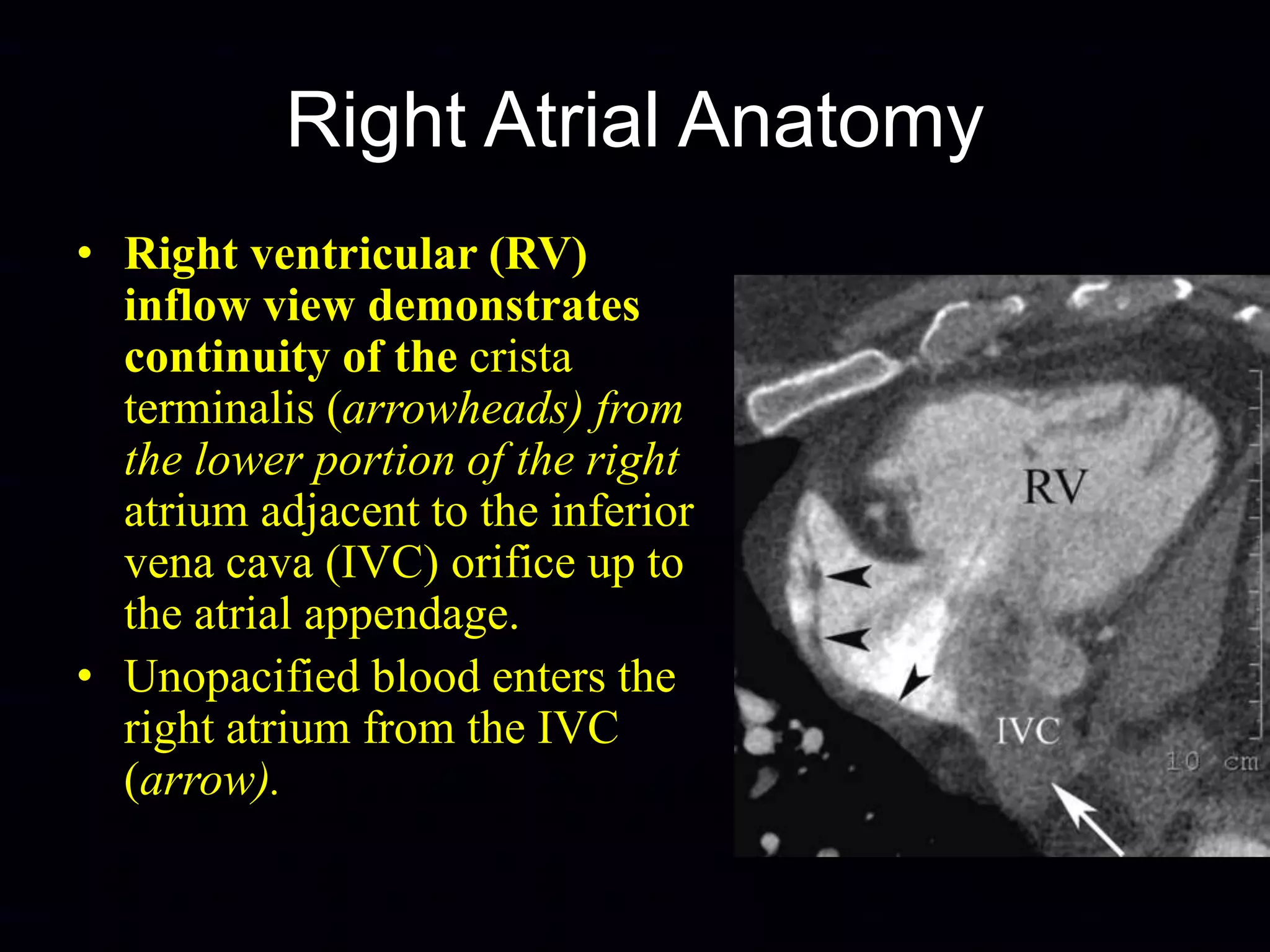 MDCT Anatomy of Heart Dr. Muhammad Bin Zulfiqar | PPTX