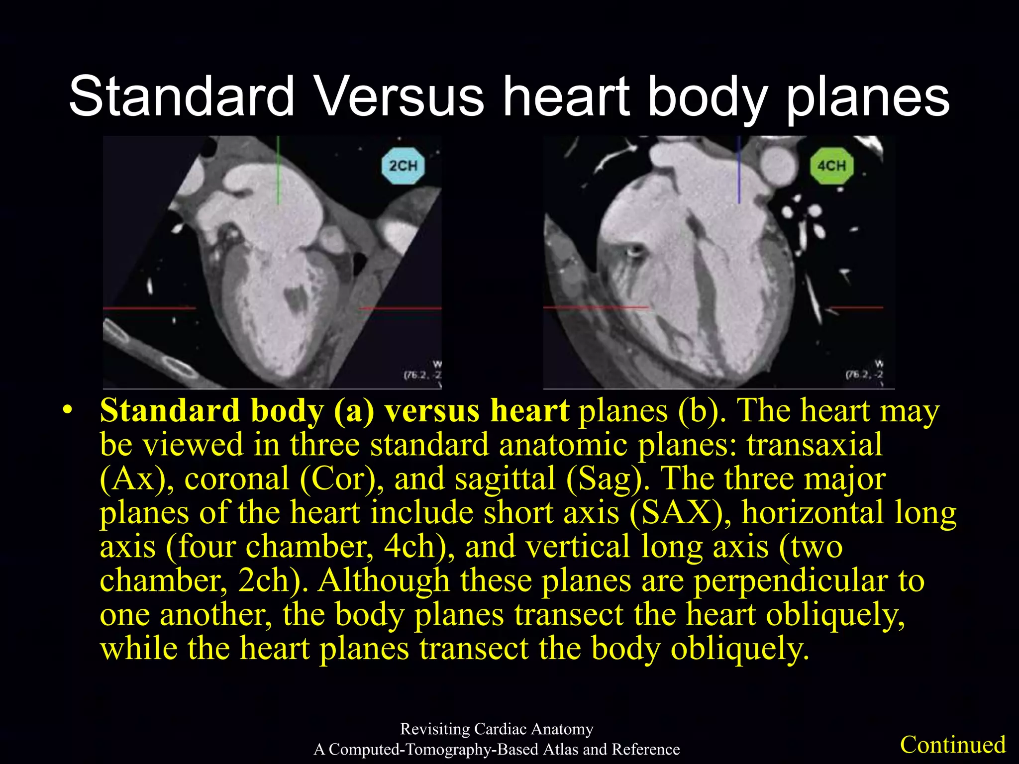 MDCT Anatomy of Heart Dr. Muhammad Bin Zulfiqar | PPTX