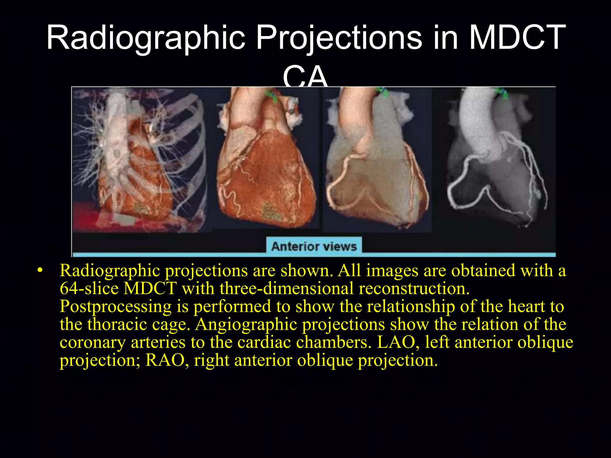 MDCT Anatomy of Heart Dr. Muhammad Bin Zulfiqar | PPTX