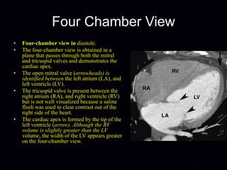 MDCT Anatomy of Heart Dr. Muhammad Bin Zulfiqar | PPTX