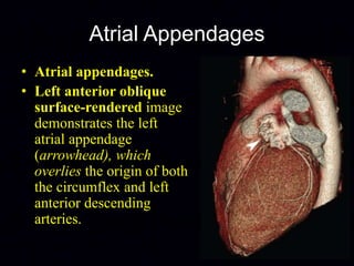 MDCT Anatomy of Heart Dr. Muhammad Bin Zulfiqar | PPTX