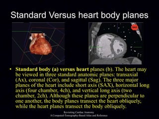 MDCT Anatomy of Heart Dr. Muhammad Bin Zulfiqar | PPTX