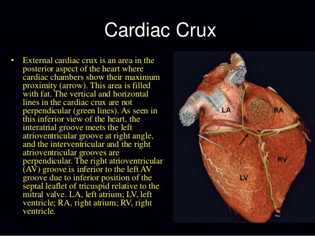 MDCT Anatomy of Heart Dr. Muhammad Bin Zulfiqar