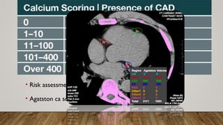 Mdct coronary | PPT