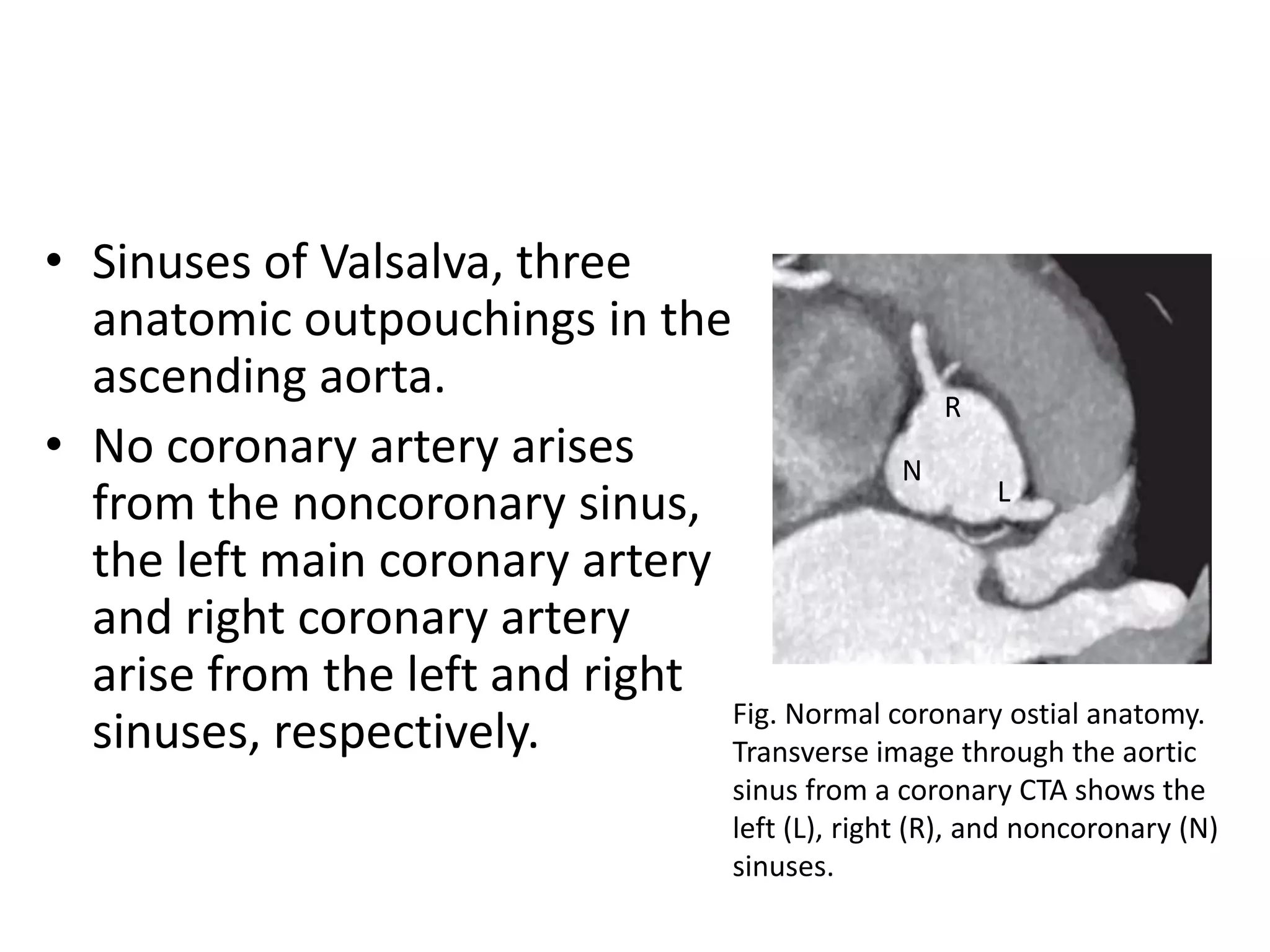 Mdct in cad | PPTX