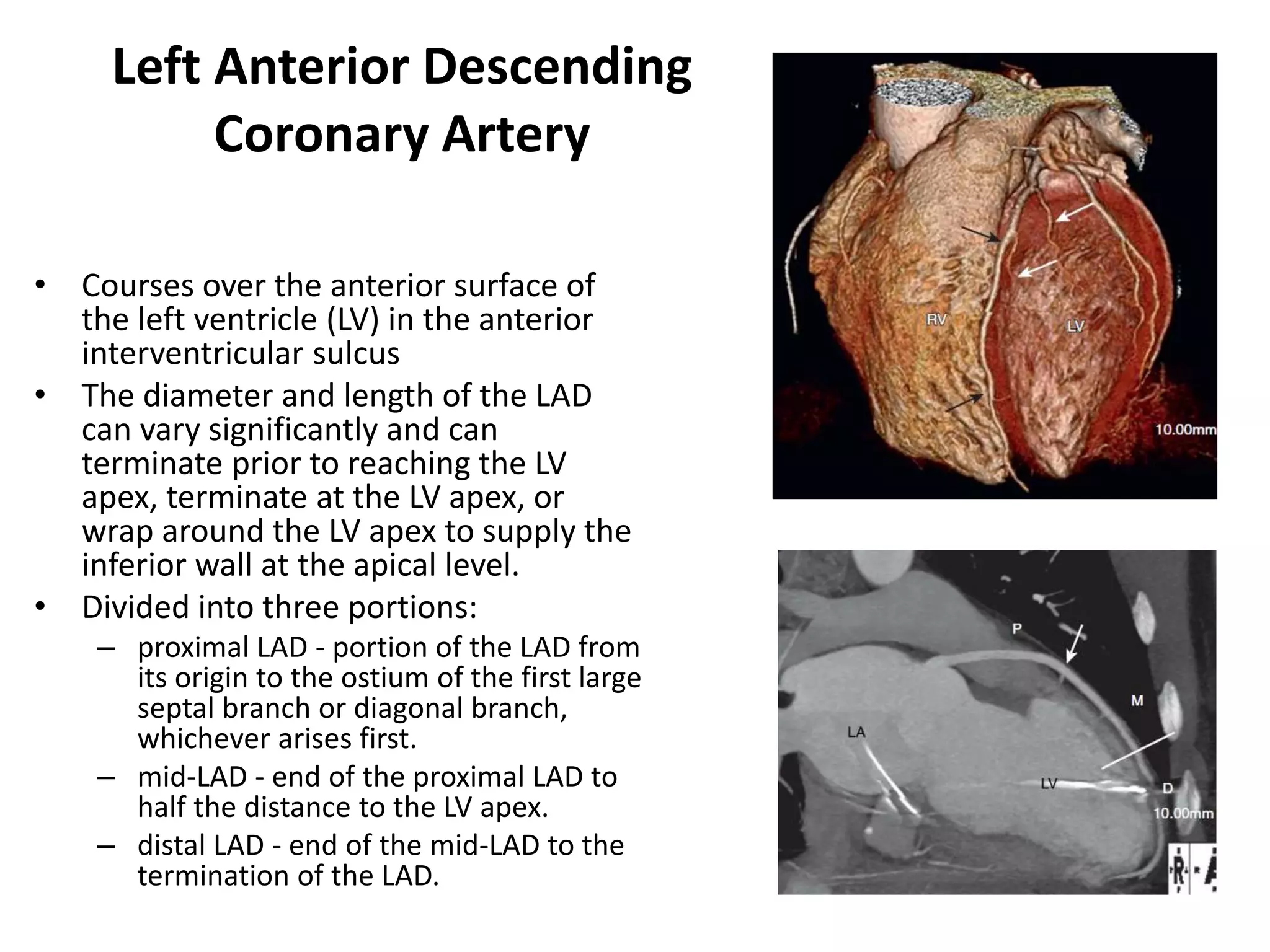 Mdct in cad | PPTX