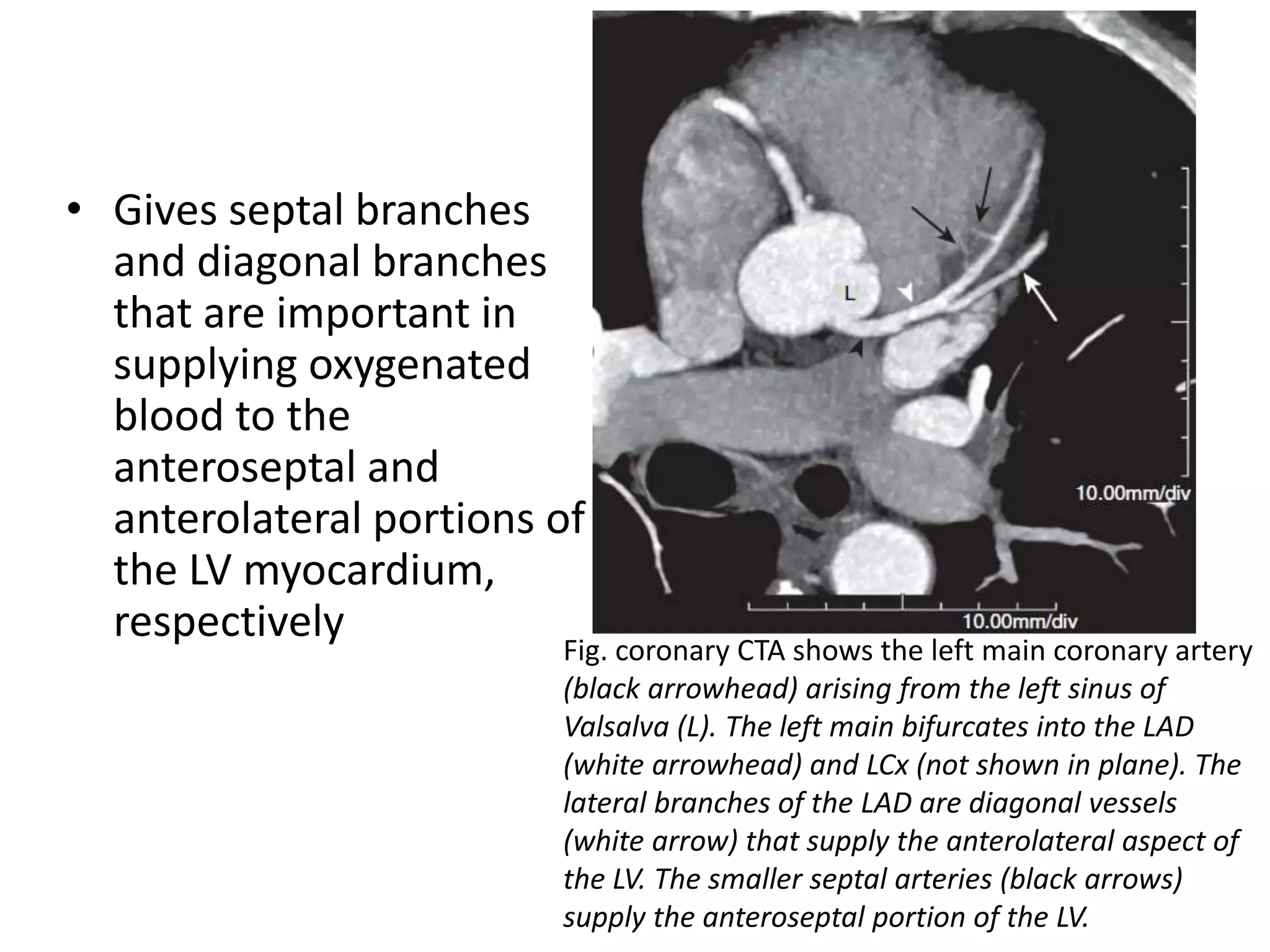 Mdct in cad | PPTX