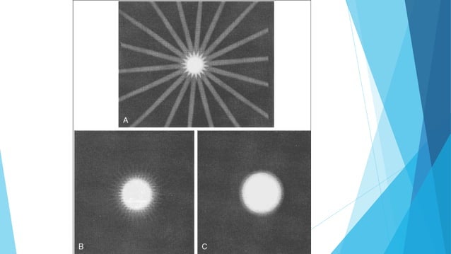 Physics of Multidetector CT Scan | PPT | Medical Tests | Medical Health