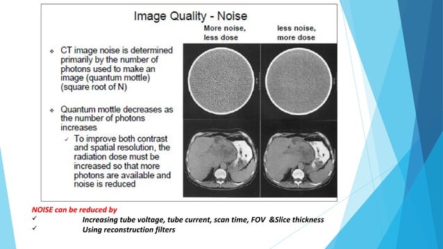 Physics of Multidetector CT Scan | PPT | Medical Tests | Medical Health