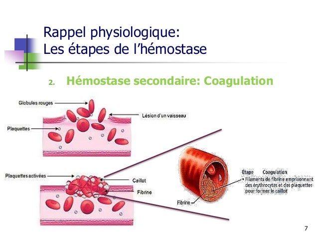 Médicaments de l’hémostase