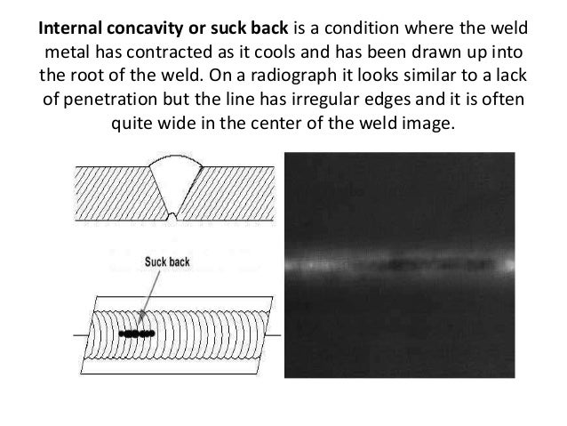 Radiography ndt