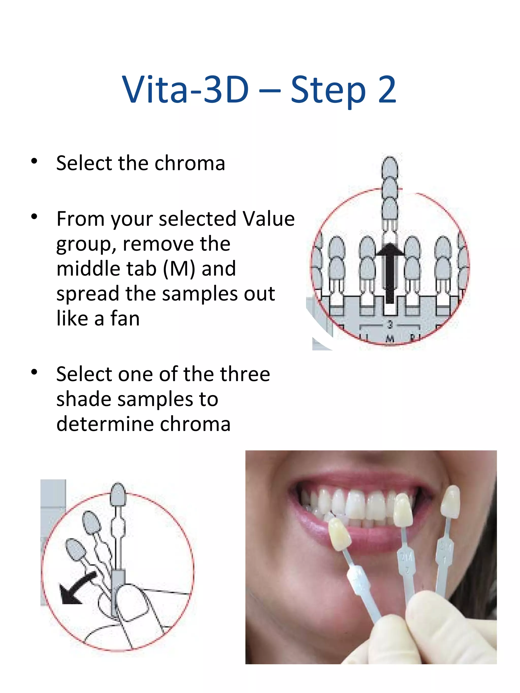 Shade selection for FPD | PPT