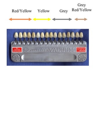 Shade selection for FPD | PPT