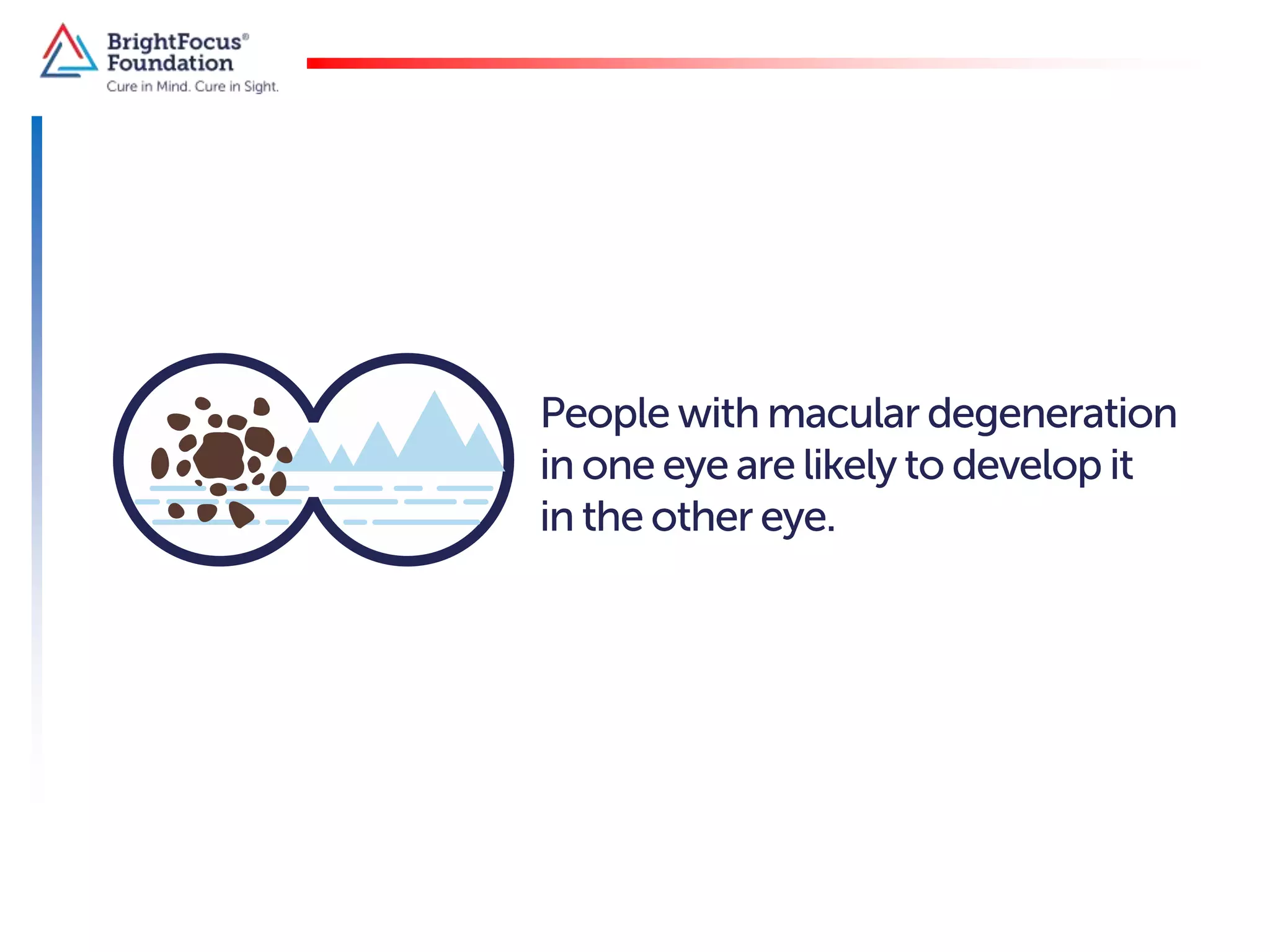 A Look at Macular Degeneration: A Leading Cause of Vision Loss | PPTX ...