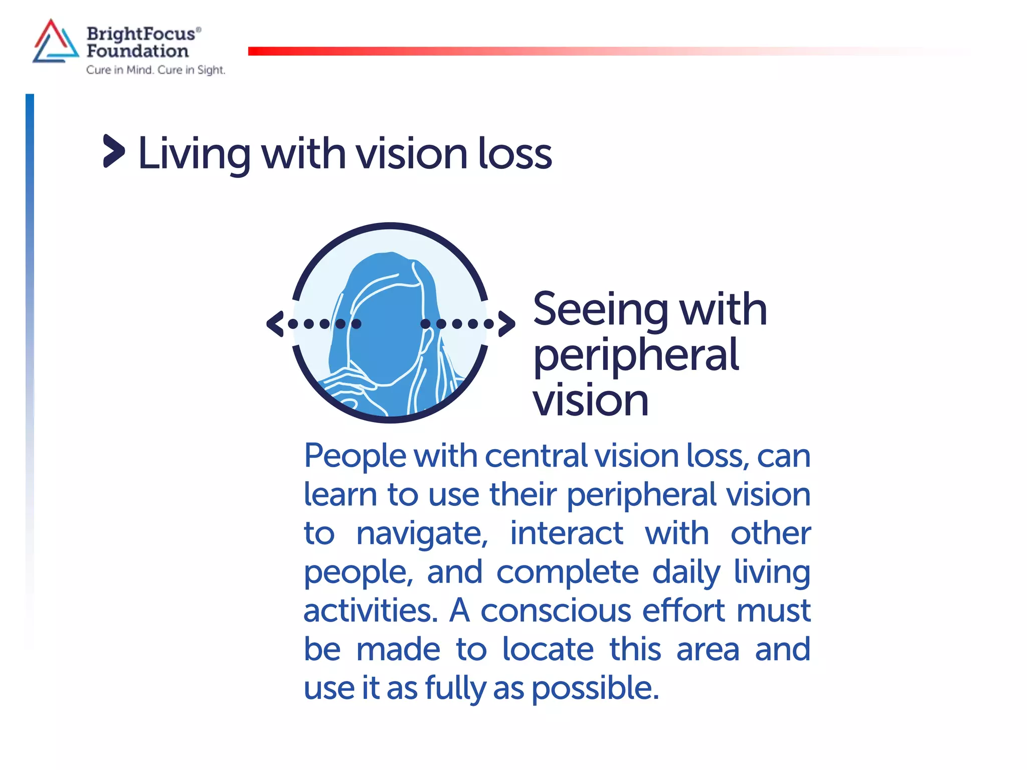 A Look at Macular Degeneration: A Leading Cause of Vision Loss | PPTX ...