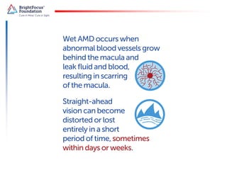 A Look at Macular Degeneration: A Leading Cause of Vision Loss | PPTX ...