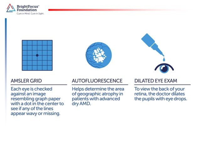 A Look at Macular Degeneration: A Leading Cause of Vision Loss | PPTX ...