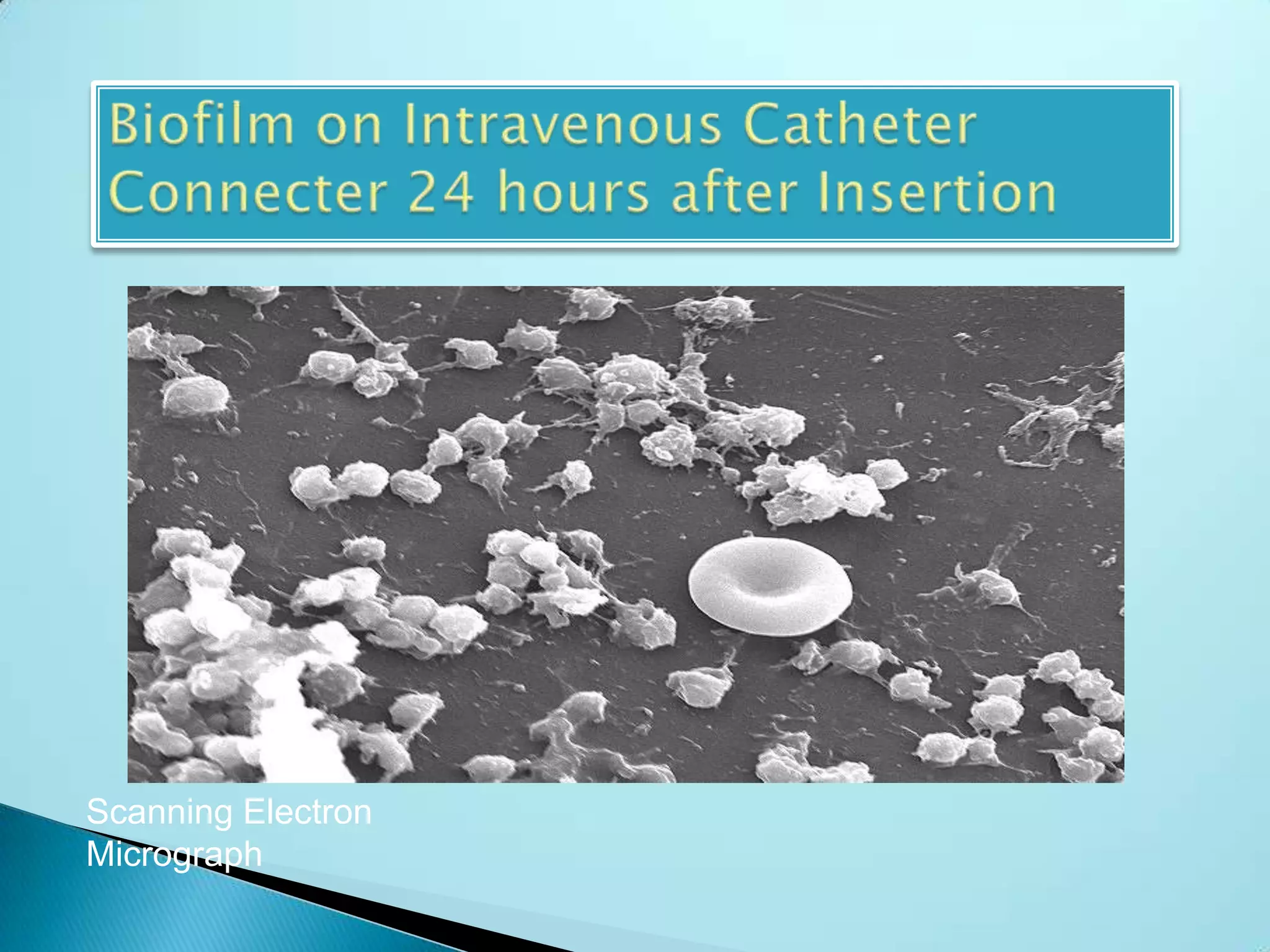 Mdro infection controlnursing final version 11.17.09 1 | PPTX