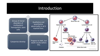 Myelodysplastic Syndrome | PPTX