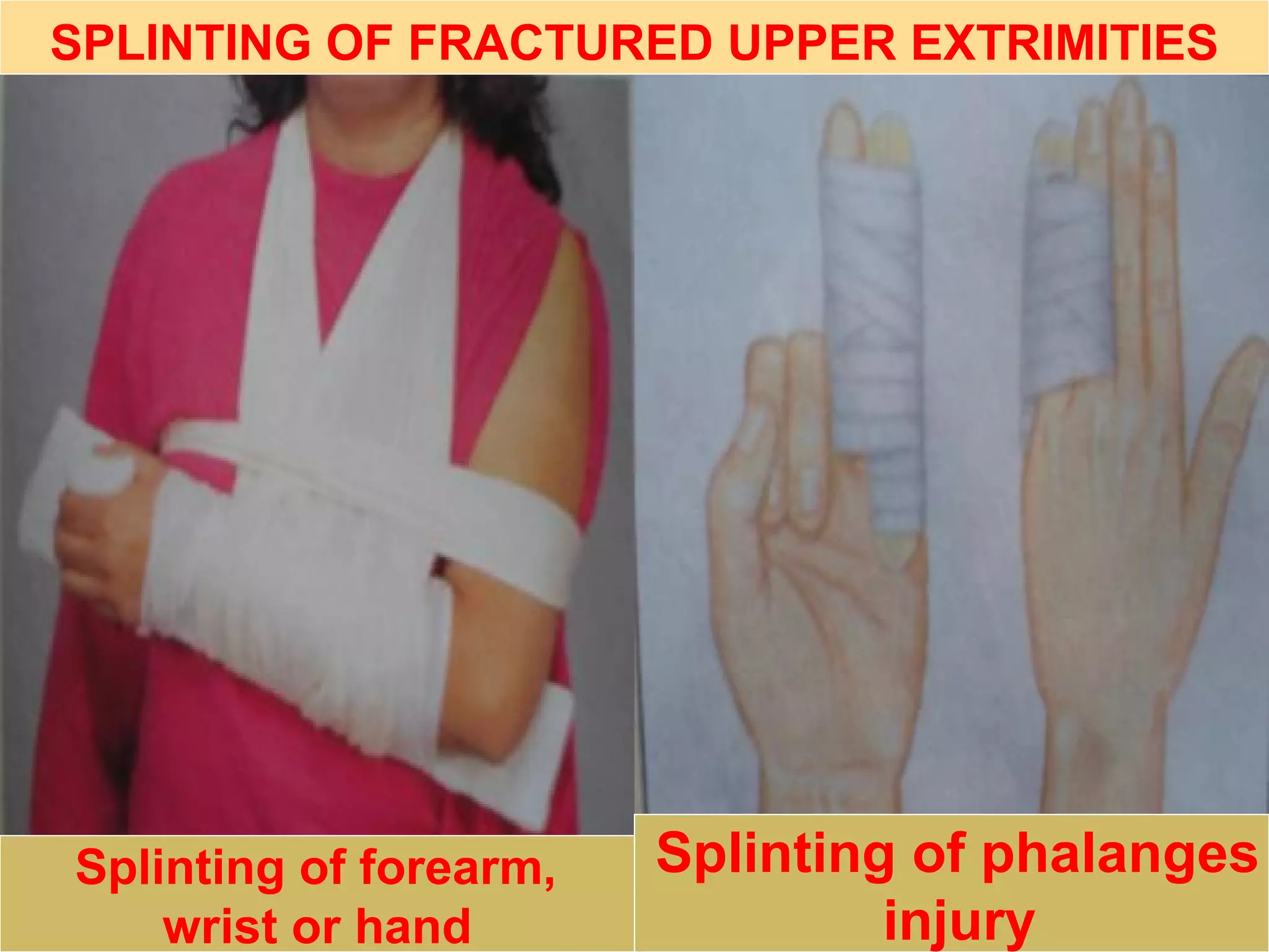 MUSCULOSKELETAL INJURIES | PPT