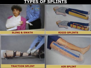 MUSCULOSKELETAL INJURIES | PPT