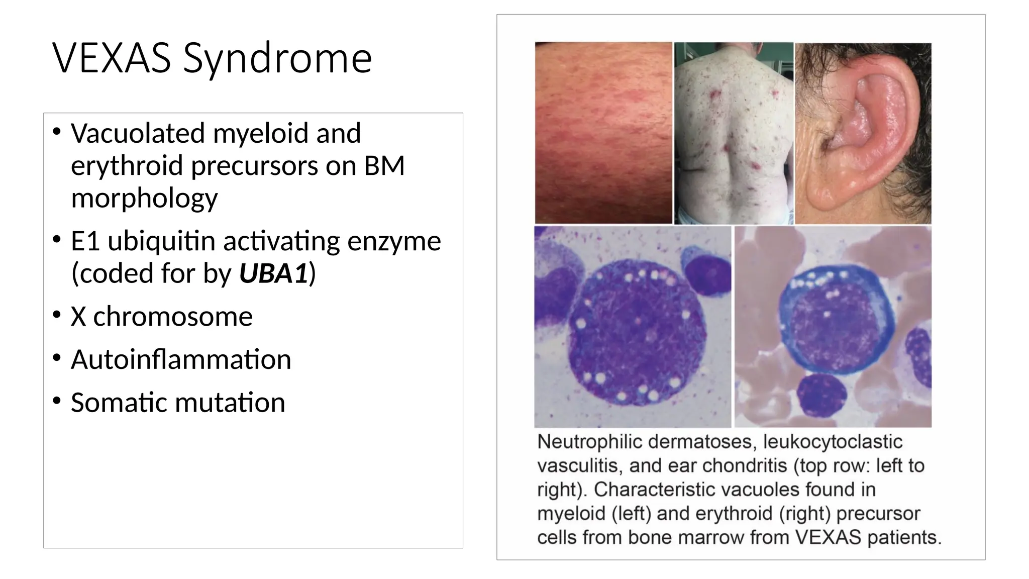 DIAGNOSIS OF MYELODYSPLASTIC SYNDROMES/NEOPLASMS | PPTX