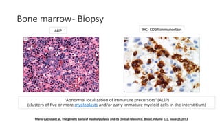 DIAGNOSIS OF MYELODYSPLASTIC SYNDROMES/NEOPLASMS | PPTX