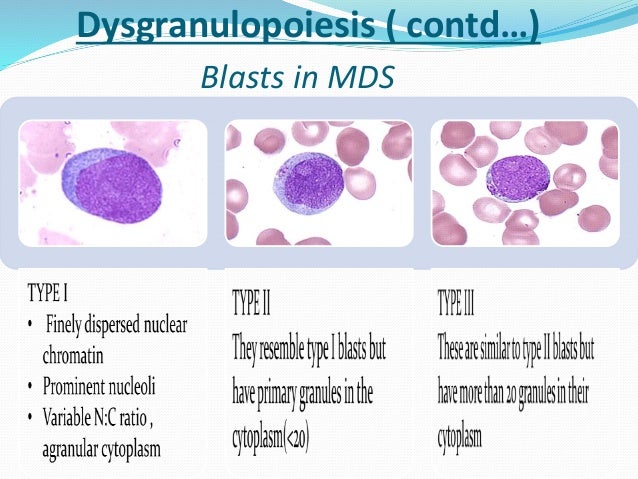 Myelodysplastic Syndrome