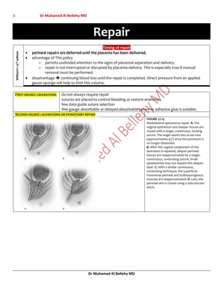 Perineal Laceration and obstetric anal sphincter injuries | PDF