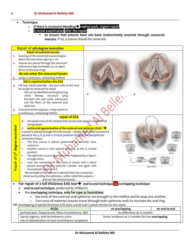 Perineal Laceration and obstetric anal sphincter injuries | PDF