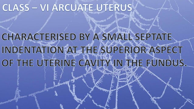 ABNORMALITY IN STRUCTURE OF UTERUS | PPTX
