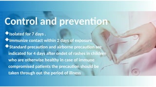 MEALES (a childhood infectious disease) | PPTX