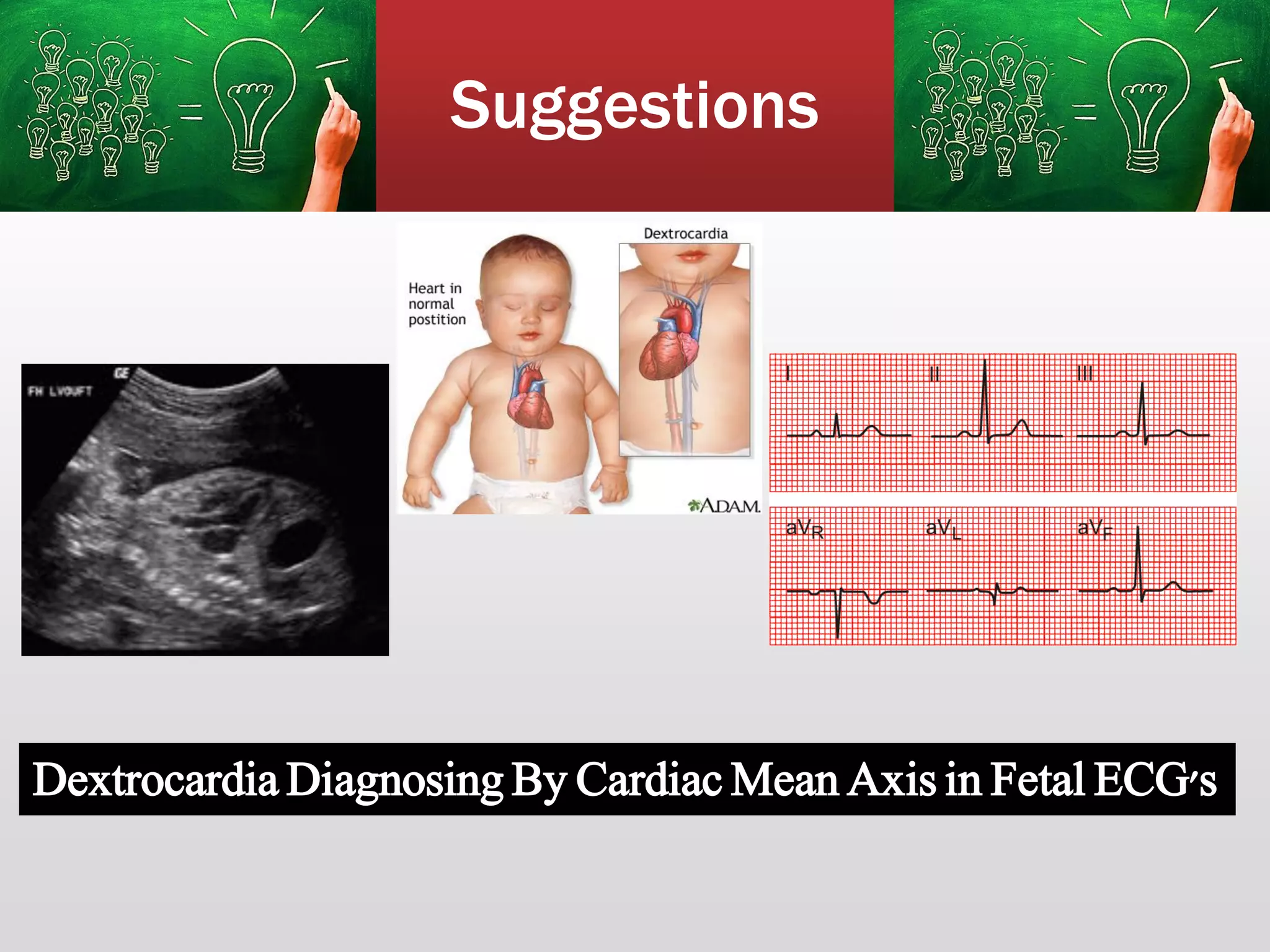 Mean cardiac axis (cardiac vector) | PPT