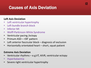 Mean cardiac axis (cardiac vector) | PPT