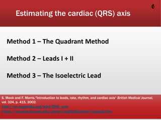 Mean cardiac axis (cardiac vector) | PPT