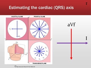 Mean cardiac axis (cardiac vector) | PDF