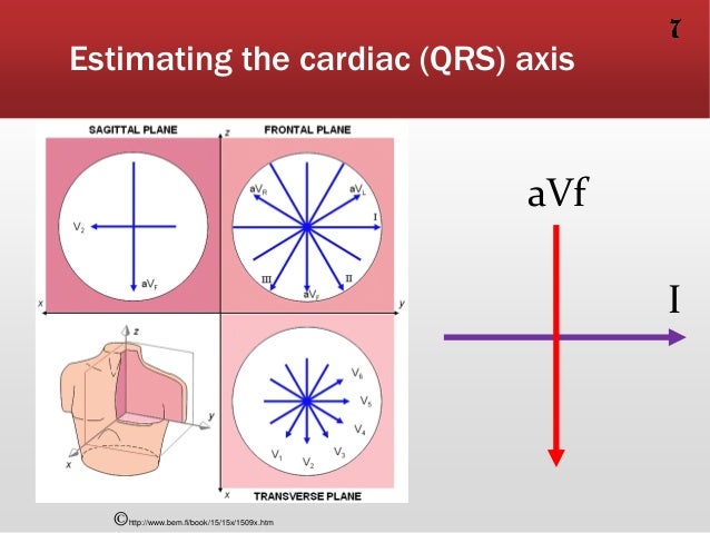 Mean cardiac axis (cardiac vector)