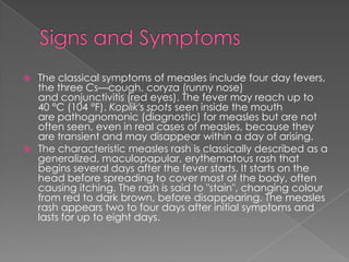 Measles - PHC | PPTX