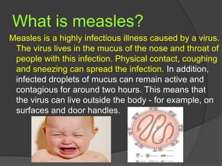 Measles | PPTX | Infectious Diseases | Diseases and Conditions