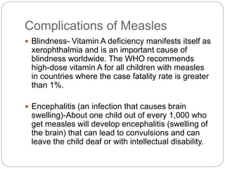 Measles Signs and Symptons | PPT