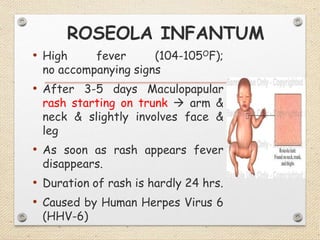 Roseola Vs Measles