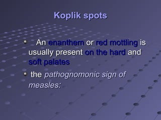 Measles | PPT