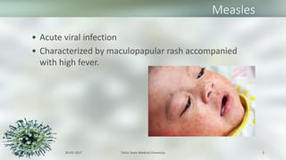 Measles | PPTX