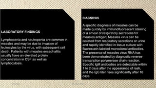 Measles | PPTX